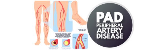 Cardiovascular Experts of PA: PAD Questionnaire - CV Experts of Central ...